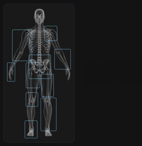 RBfractureTM: Fracture Detection in X-ray Imaging | TestDynamics